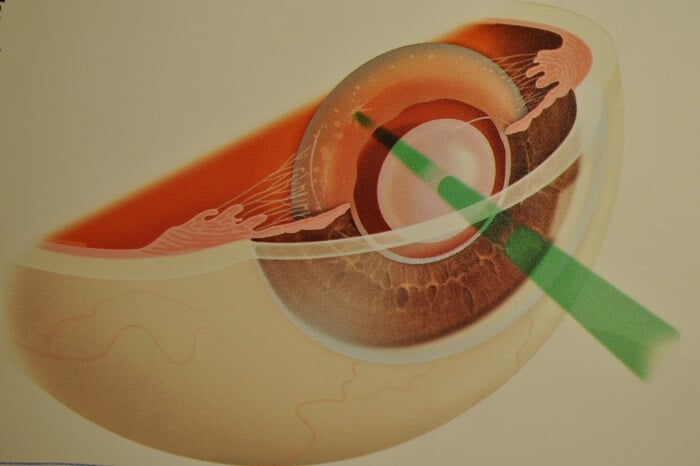 Eye Care - Altoona, PA - Altoona Ophthalmology Associates