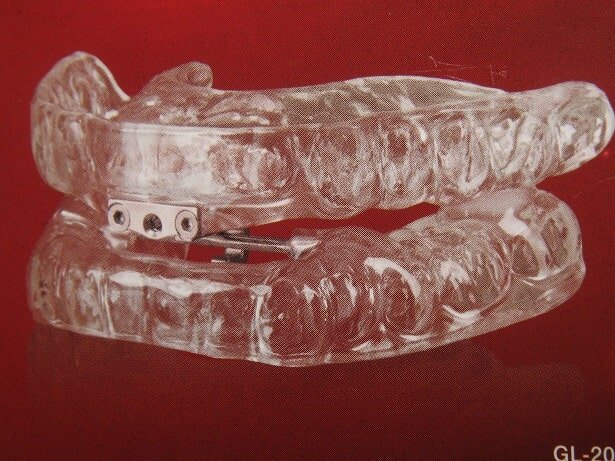 Snoring Guards | Greenville, SC | Caring Family Dentistry