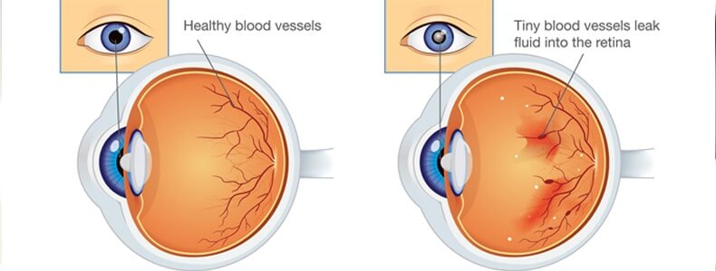 Glasses | Lake Jackson, Texas | The Eye Contact, Inc.