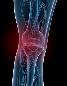 Physical Therapist's Guide to Plica Syndrome