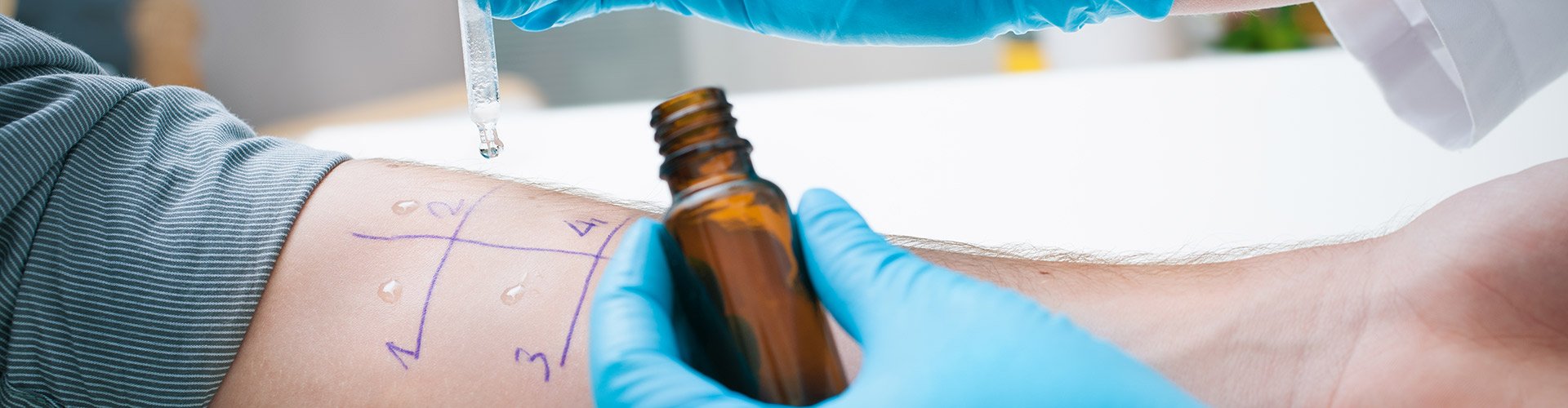 Allergy Skin Testing Near Irving, TX