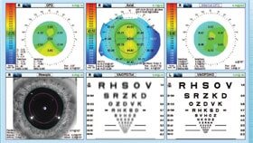 Eye Examination - Middletown, RI - Eye Care for RI