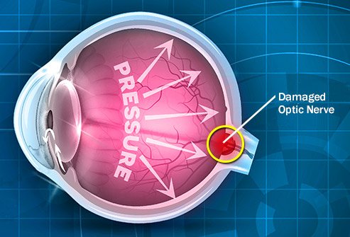 Ophthalmology Practice | Saint Cloud, MN | Eye Associates Of Central ...