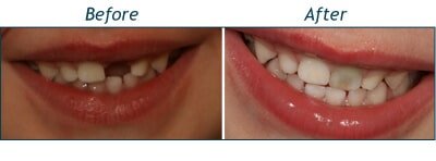 Dental reviews – Lincolnton, NC - Dedmond & Tallent Dentistry