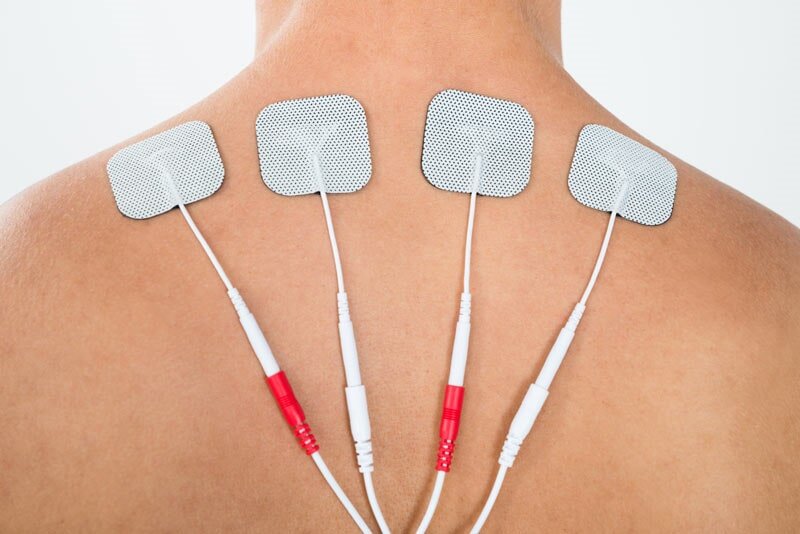 Implantation of Neuromodulator Delivery Pain Devices